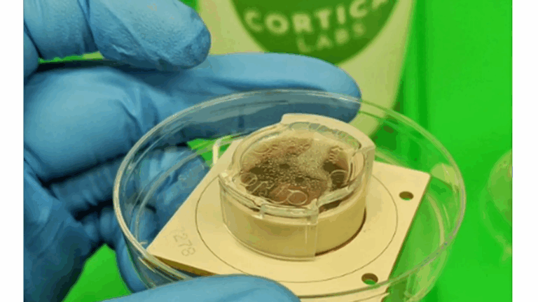 Is it ethical to grow brains in labs? – Current Happenings Across STEM Magazine